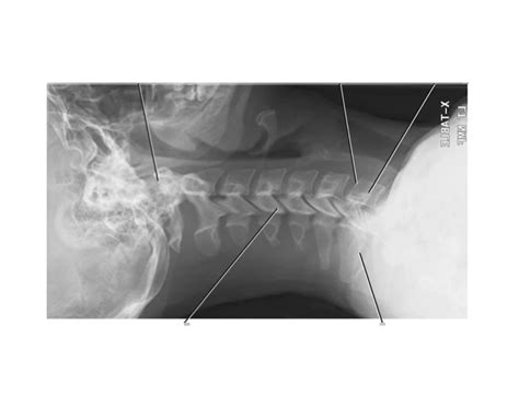 Lateral C Spine Horizontal Beam Quiz