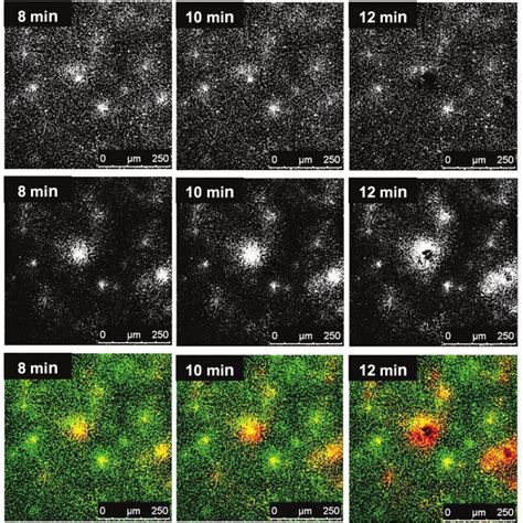 Visualization Of Fibrin Network Formation And Lysis By Confocal Laser Download Scientific