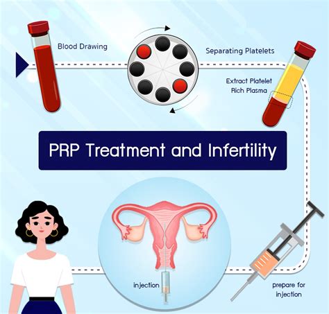 IVF Ovarian PRP PRP Ovarian Rejuvenation Lifeline Turkey