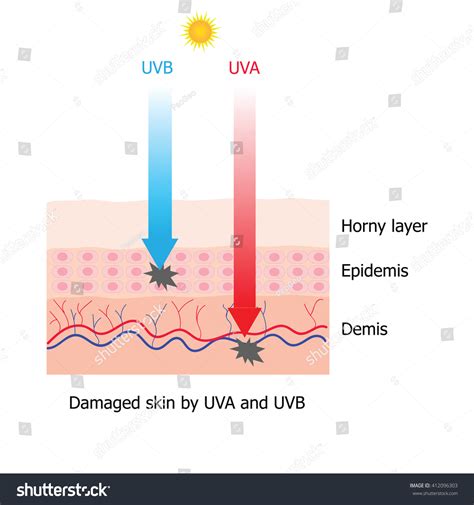 Skin Damaged By Uva Uvb Ray Stock Vector Royalty Free Shutterstock