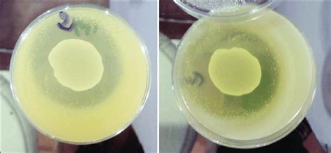 Antimicrobial Activity Of Isolated Lactobacillus Spp Clear Zone