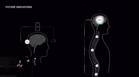 daniel r on linkedin neuralink elonmusk ai disruptor