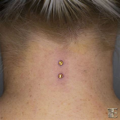 How Do Dermal Anchors Work