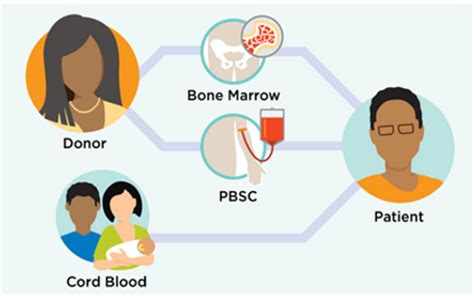 Allogeneic Bone Marrow Transplants