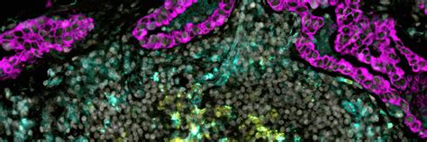 Spatial Biology Applications Nikon Bioimaging Lab Usa Nikon