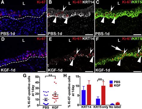 购买cyclophosphamide Monohydrate 环磷酰胺一水物 Dna Alkylator Chemical 价格 Ic50 只能用于研究
