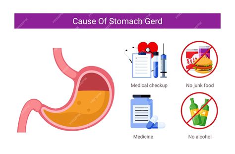 Premium Vector Causes Of Stomach Gerd Illustration