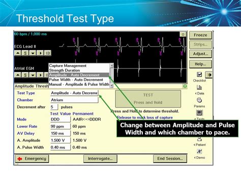 Cvt Mohd Farid Pacemaker Follow Up Part Ii Medtronic Academy