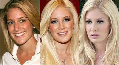Celebrity Plastic Surgery Before And After 56 Pics Plastic Surgery
