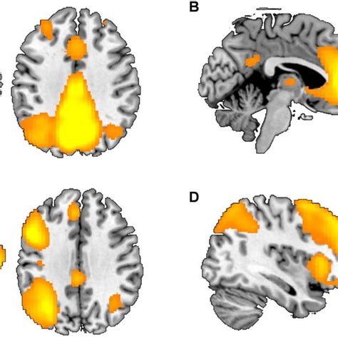 Resting State Networks Identified Using Independent Component Analysis Download Scientific
