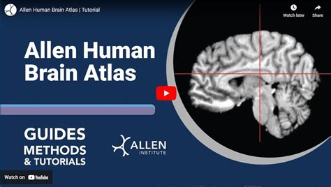 Allen Human Brain Atlas Youtube Tutorial Allen Human Brain Atlas Allen Brain Map Community