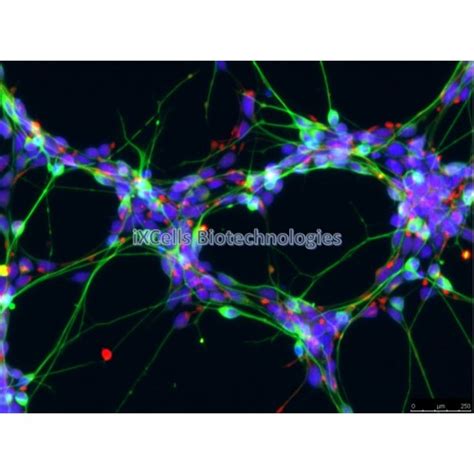 Human Motor Neurons Ipsc Derived Sod1 Mutant A4v