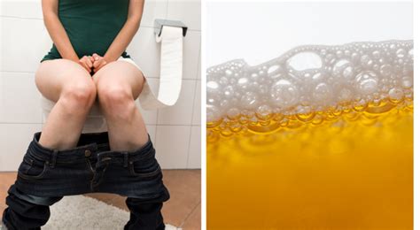 Vidite li mjehuriće u urinu To može ukazivati na ozbiljnije zdravstveno stanje Mega Vijesti