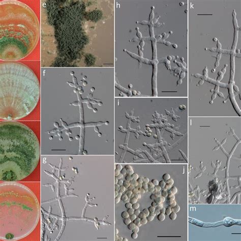 Cultures And Asexual Morph Of Trichoderma Polysporum Ad Cultures At