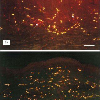 TCMC Yellow Green Color And TMC Orange Color In A Reversal Reaction Download Scientific