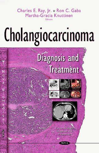 Cholangiocarcinoma Diagnosis And Treatment Cancer Etiology Diagnosis And Treatments
