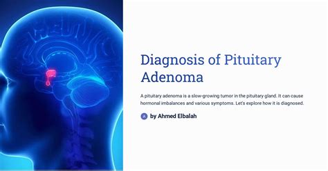 Diagnosis Of Pituitary Adenoma