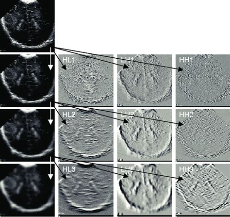 An Illustration Of The Non Decimated Wavelet Transform Left Column Download Scientific