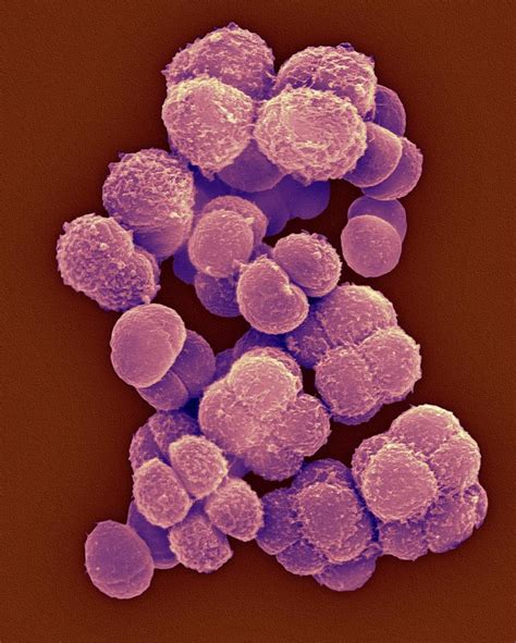 Deinococcus Sp Coccoid Prokaryote Photograph By Dennis Kunkel Microscopy Science Photo Library