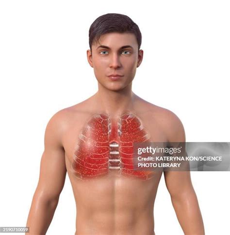 Lung Miliary Tuberculosis Illustration High Res Vector Graphic Getty Images