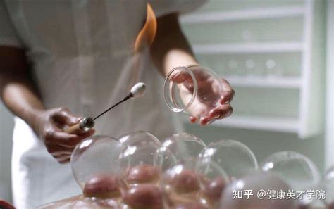 刺络拔罐法效果奇佳 知乎