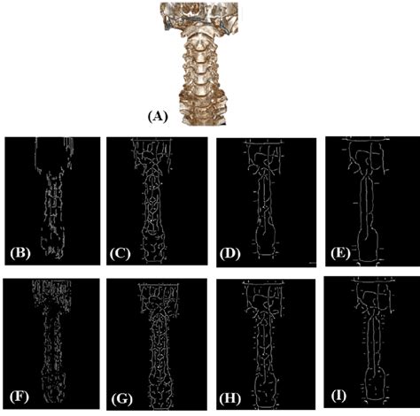 Ridge Detection Technique Generated The Extracted Images 8 Models Were