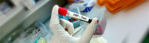 Crp Test Redcliffe Community