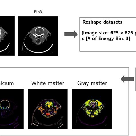 Photon Counting Detector System Consisting Of Cdte Download Scientific Diagram