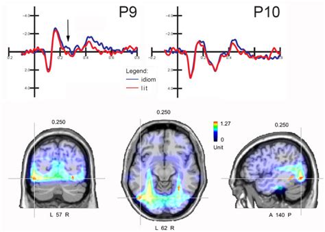 Final Words Top Erp Recorded At Left And Right Occipitotemporal
