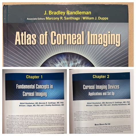 Mehdi Roozbahani Md On Linkedin Atlasofcornealimaging