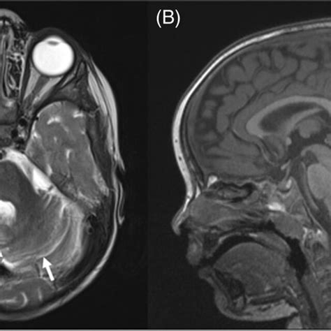 Diagram Demonstrating The Current Understanding Of The Ctbp1 Protein In Download Scientific