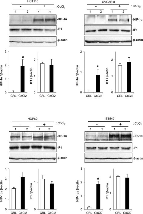 Expression Regulation And Clinical Relevance Of The Atpase Inhibitory Factor 1 In Human Cancers