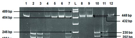 Representative Pattern For Three Genotypes Of P53 Exon 4 Arg72pro