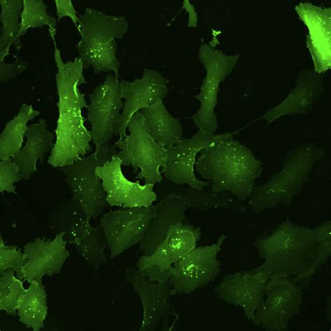 Segmenting Cells And Subcellular Particles Image Analysis Imagesc