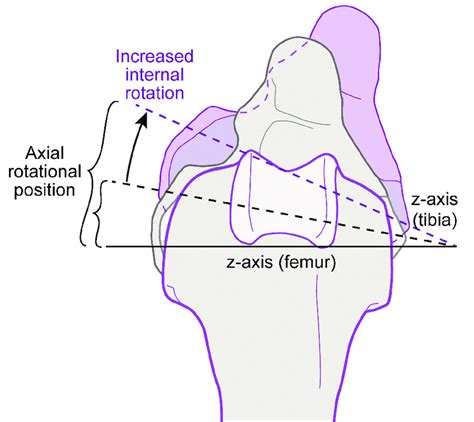 Depiction Of Axial Rotational Kinematics Terminology To Describe Axial Download Scientific