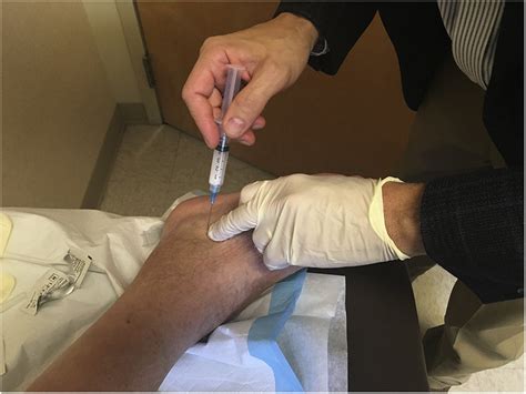 Subtalar Joint Injection Through A Lateral Approach The Provider Is Download Scientific