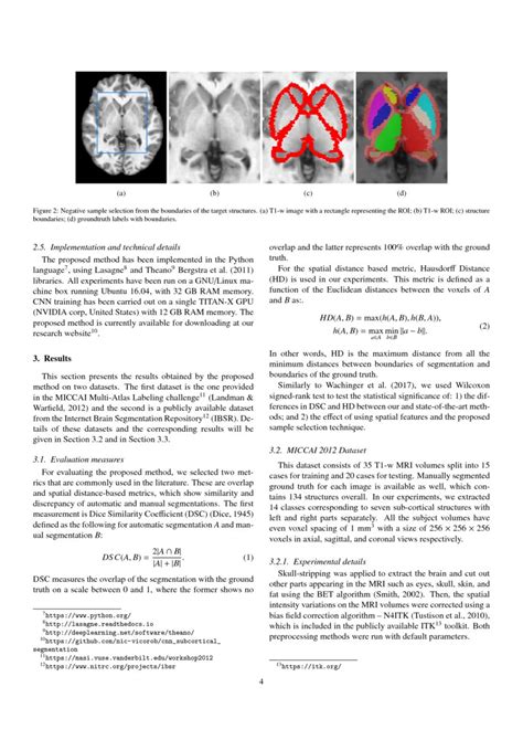 Automated Sub Cortical Brain Structure Segmentation Combining Spatial