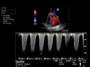 RVSP How To Saving Lives With Sound