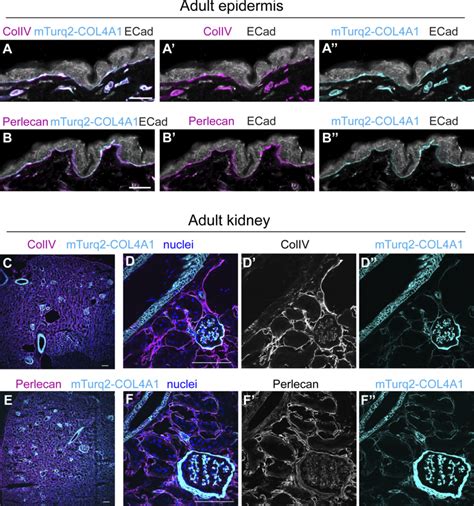Related To Fig 1 Mturq2 Col4a1 Basement Membrane Localization In Download Scientific Diagram