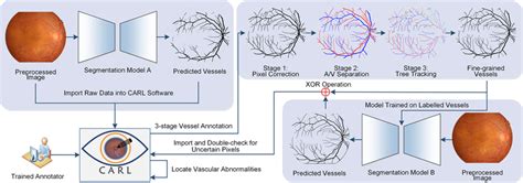 The Proposed Workflow For Generating Fine Grained Vessel Annotations Download Scientific