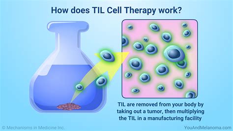 Slide Show Til Cell Therapy For Melanoma