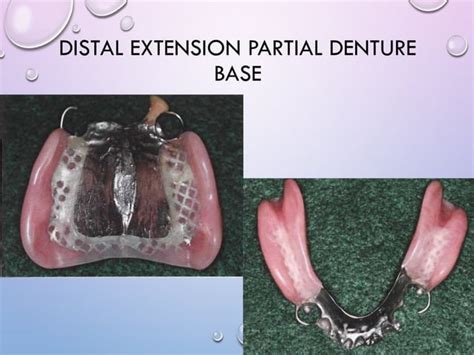 Denture Base Power Point Presentation Pptx