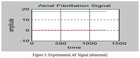 Wavelet Transform Based Feature Extraction And Classification Of Atrial Fibrillation Arrhythmia