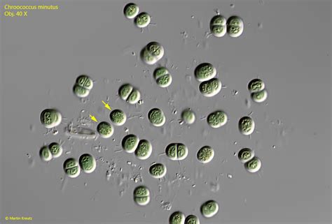 Chroococcus Minutus Real Micro Life