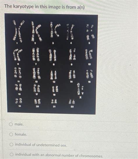 Solved The Karyotype In This Image Is From A N Male Chegg Com