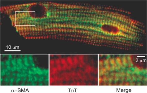 Intracellular Localization Of α Sma Shows Non Complete Overlap With The