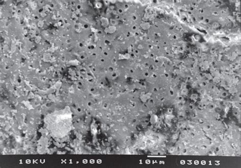 Scanning Electron Microscopy Sem Micrograph Of Root Dentin Surface Download Scientific