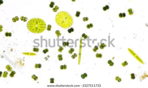Algae Under Microscope Labeled