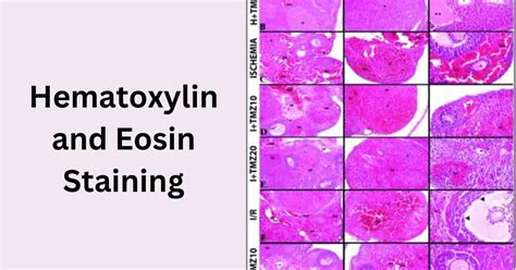 Hematoxylin And Eosin Staining A Comprehensive Guide For Histopathology