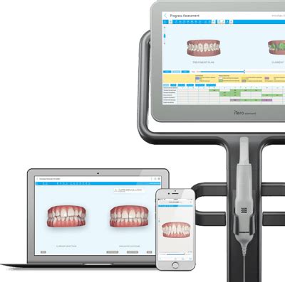 ITero Scan Holland Park Dental